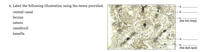 Solved: Label The Following Illustration Using The Terms P... | Chegg.com Solved: Label The Following Illustration Using The Terms P... | Chegg.com