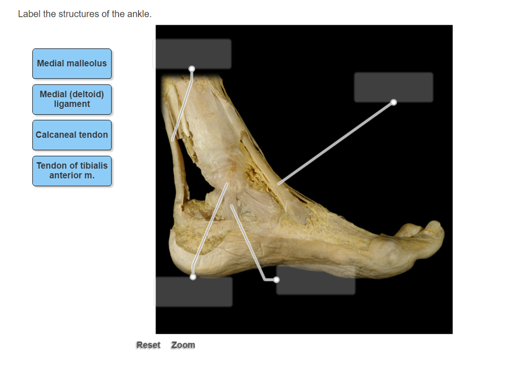 Solved: Label The Structures Of The Ankle. | Chegg.com Solved: Label The Structures Of The Ankle. | Chegg.com