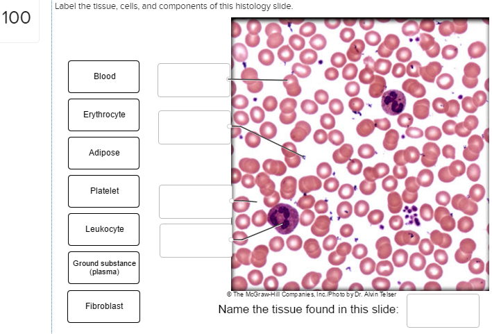Solved: Label The Tissue, Cells, And Components Of This Hi... | Chegg.com Solved: Label The Tissue, Cells, And Components Of This Hi... | Chegg.com