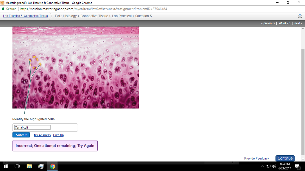 Solved: Mastel NgAandP: Lab Exercise 5: Connective Tissue ... | Chegg.com