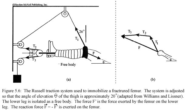 The Pulley Positions Are Adjusted So That The Vect... | Chegg.com