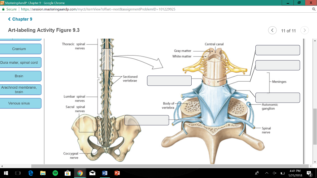 Solved: Choices: Pia Matter, Brain CSF-filled Subarachnoid... | Chegg.com