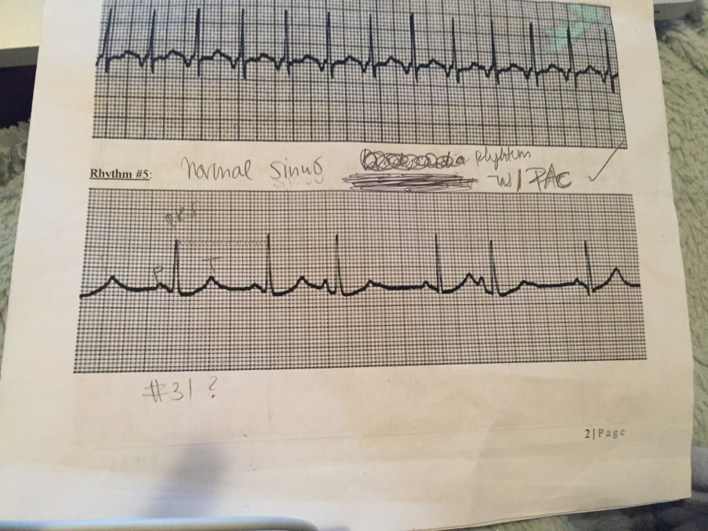 Solved RHYTHM # 5 NORMAL SINUS RHYTHM W/ PAC Question 30 | Chegg.com