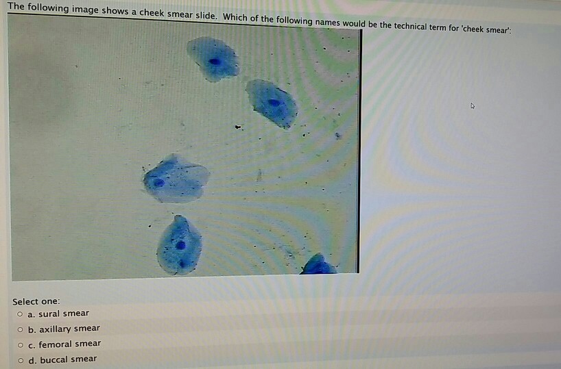 Solved The following image shows a cheek smear slide. Which | Chegg.com