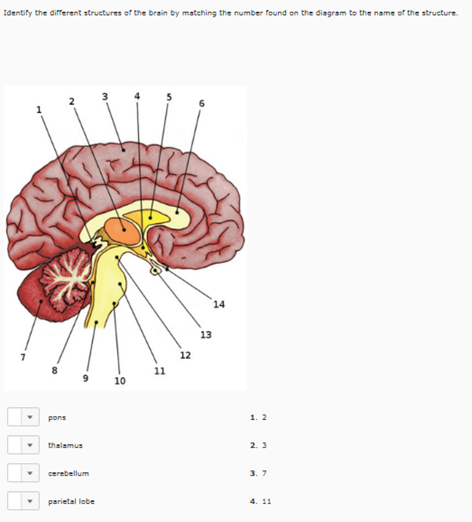 Solved Identify the different structures of the brain by | Chegg.com