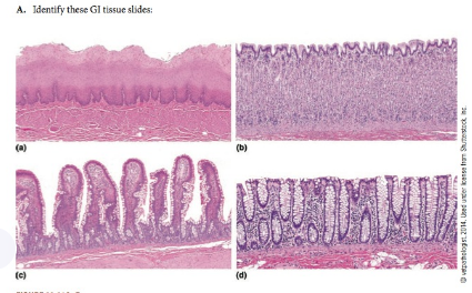 Solved Identify these GI tissue slides: | Chegg.com