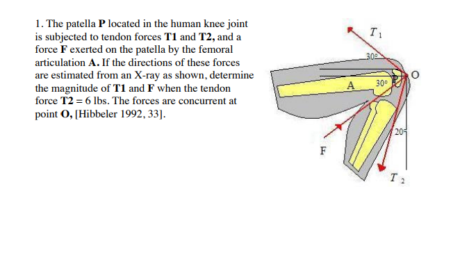 Solved 1. The patella P located in the human knee joint is | Chegg.com