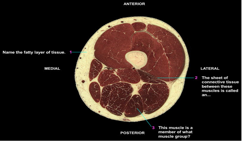 Solved 3a) Name the layer of fatty tissue that lies | Chegg.com