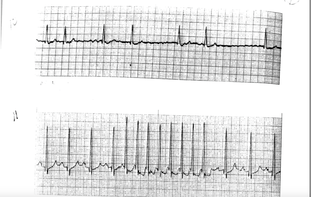 Solved IDENTIFY each one of the rhythms using the process of | Chegg.com
