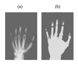Solved Please help me with following: two X-ray images of | Chegg.com