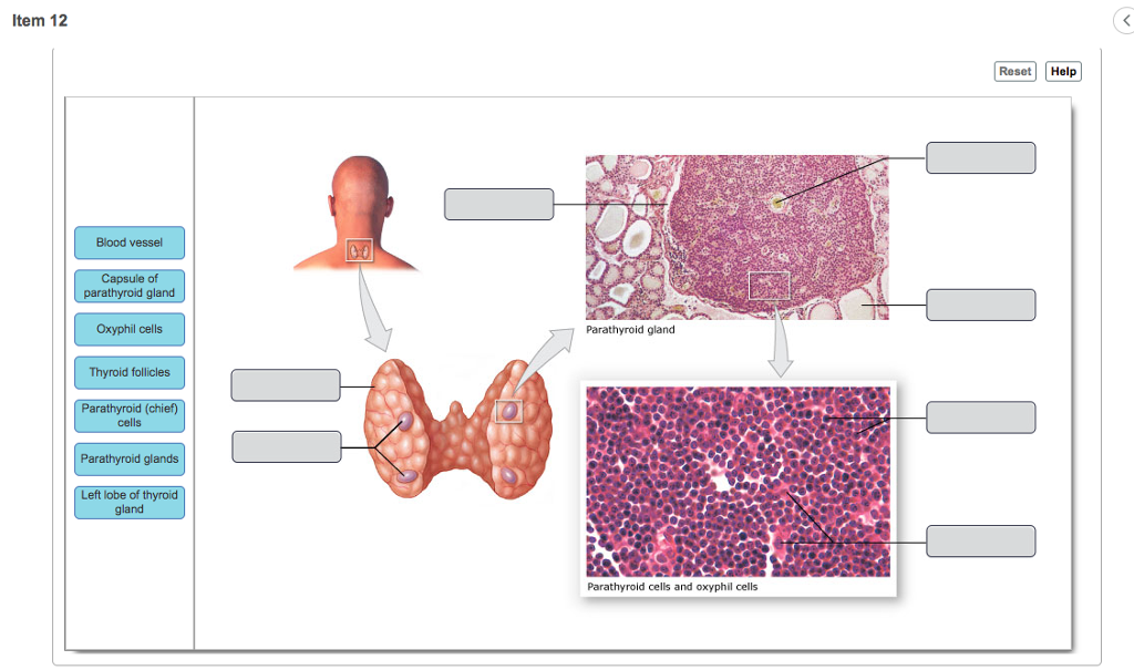 Solved Item 12 Reset Help Blood vessel Capsule of | Chegg.com