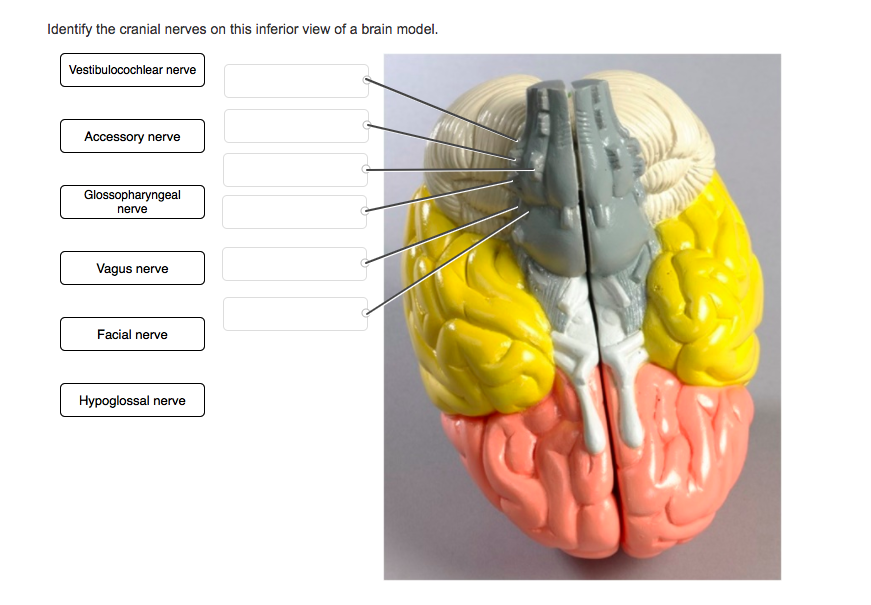 Solved Identify the cranial nerves on this inferior view of | Chegg.com