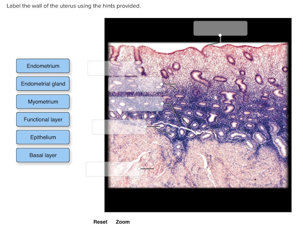 Solved Label the wall of the uterus using the hints provided | Chegg.com