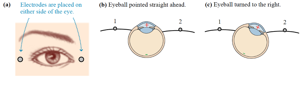 Solved The eye has a modest dipole moment, with the cornea | Chegg.com