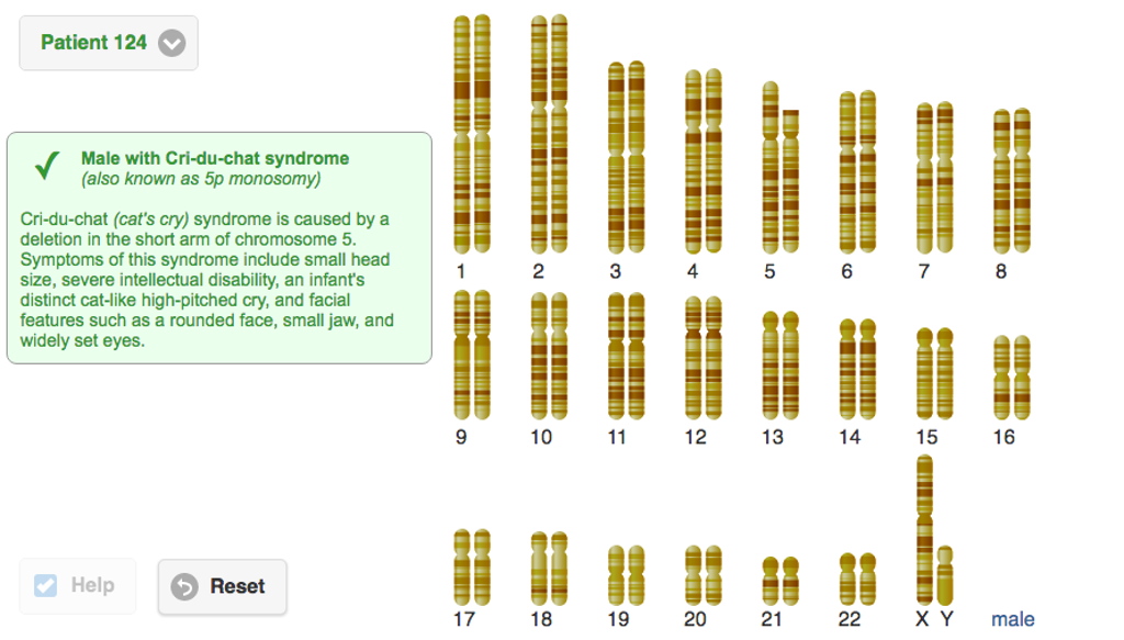 Solved Use the Karyotypes interactive, Abnormal Karyogram | Chegg.com