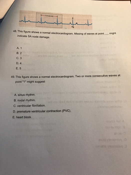 Solved 48. This figure shows a normal electrocardiogram. | Chegg.com