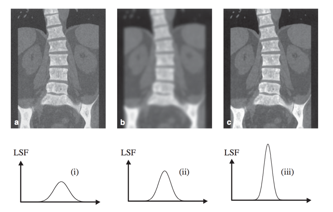 Shown in Figure 2.44 are three CT images: one | Chegg.com
