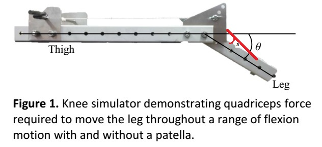 Solved A simulation of forces on a patella are shown above. | Chegg.com