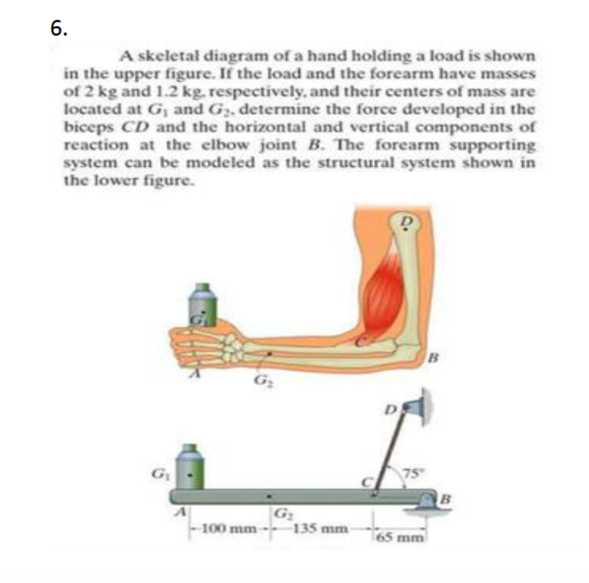 Solved A skeletal diagram of a hand holding a load is shown | Chegg.com