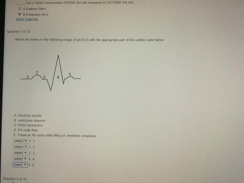Solved Match the letters in the following image of an ECG | Chegg.com