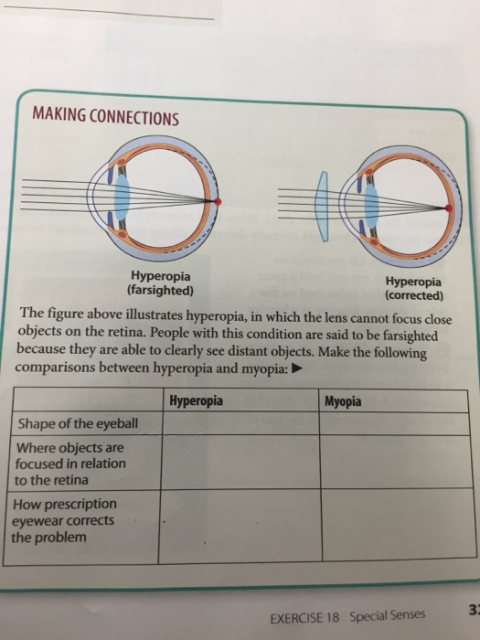 Solved The figure above illustrates hyperopia, in which the | Chegg.com