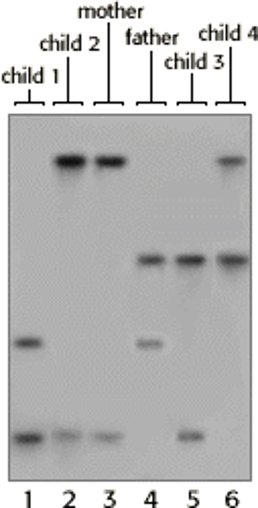 Solved 3) Results from a single locus probe DNA fingerprint | Chegg.com