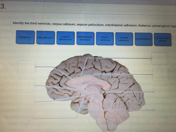 Solved Identify the third ventricle, corpus callosum, septum | Chegg.com