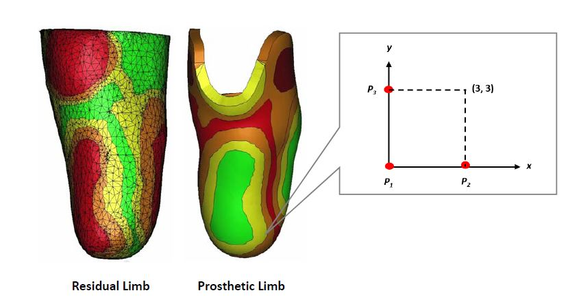 Consider a residual limb in an amputee as shown in | Chegg.com