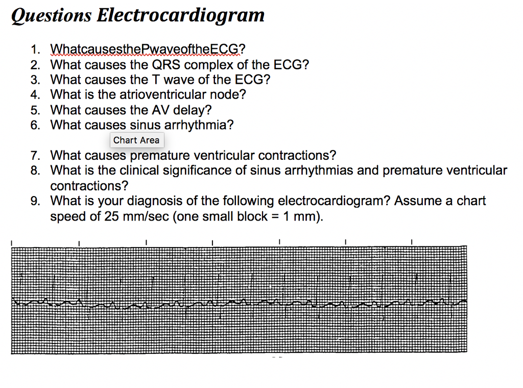 Solved Questions Electrocardiogranm 1. | Chegg.com