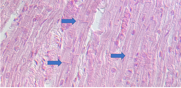 Skeletal Muscle 40x