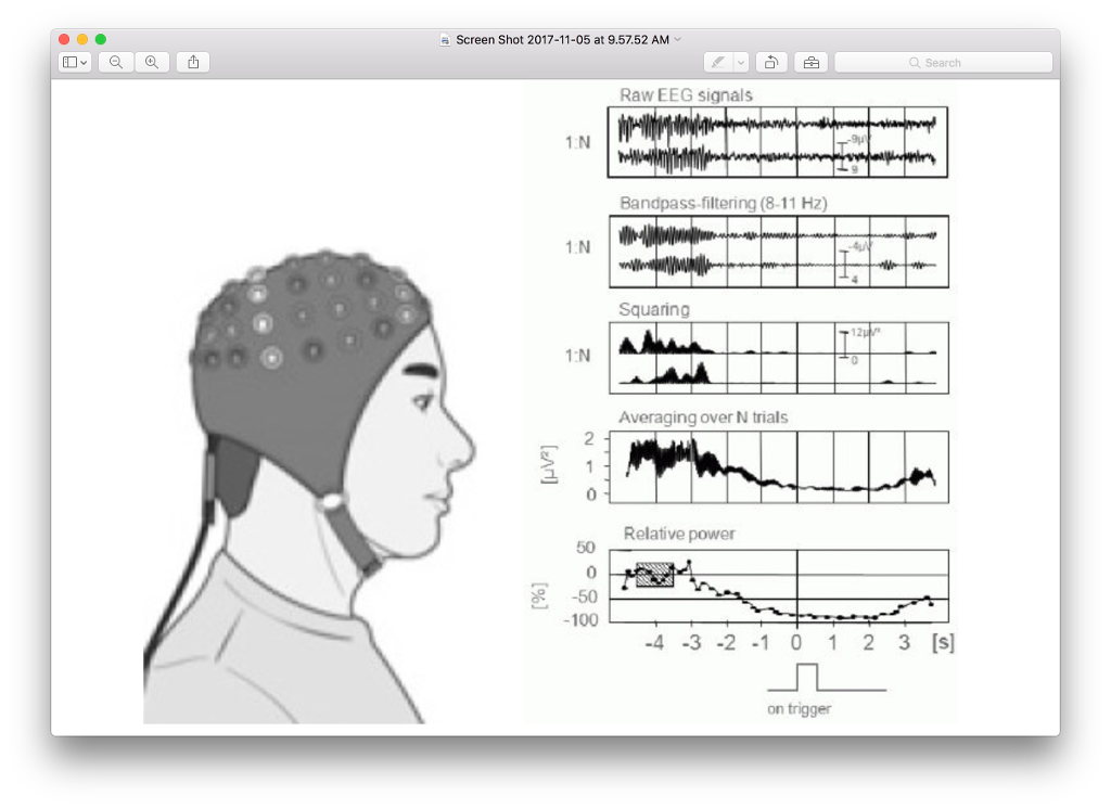 “Sensory, cognitive and motor processing can result | Chegg.com