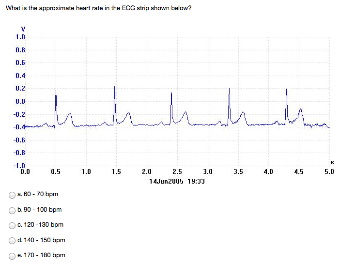 Solved What is the approximate heart rate in the ECG strip | Chegg.com