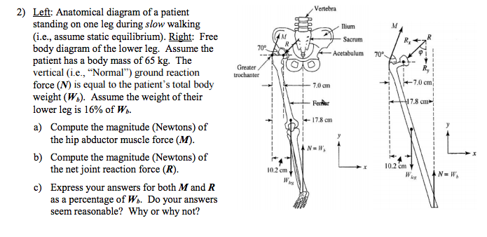 Solved 2) Left: Anatomical diagram of a patient standing on | Chegg.com