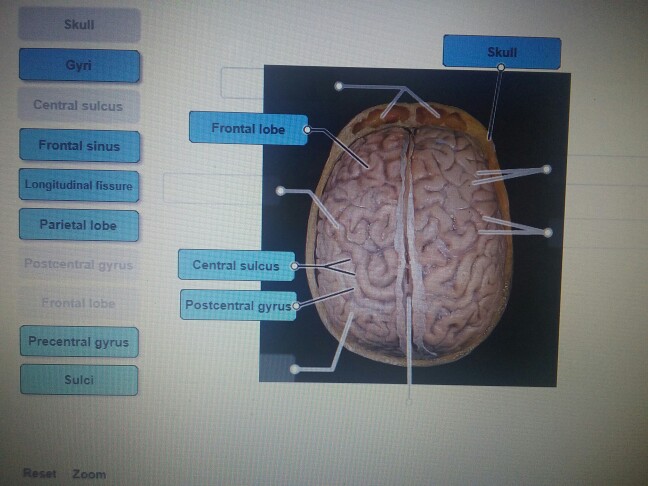 Solved Skull Skull Gyri Central sulcus Frontal lobe Frontal | Chegg.com