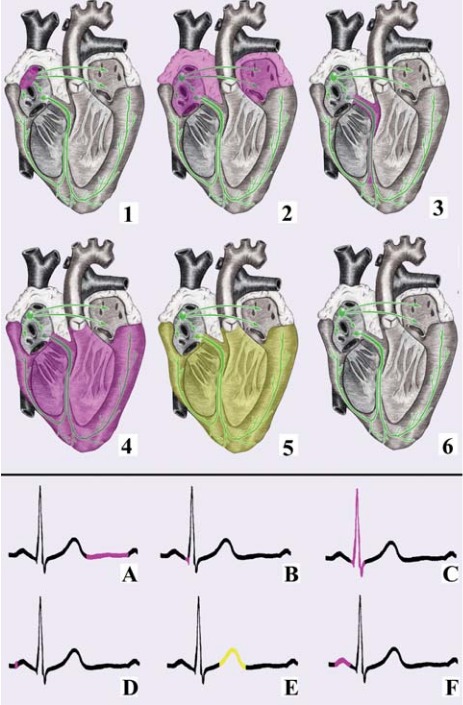 Solved Shown below at the top of the image is the cardiac | Chegg.com
