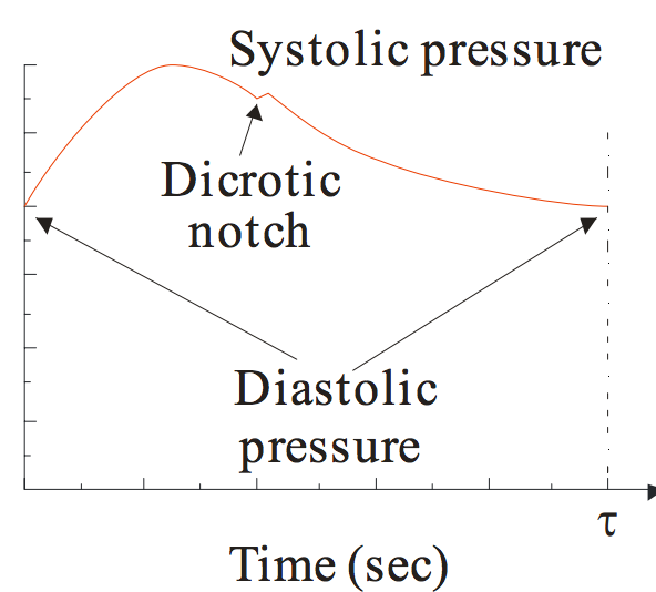 In matlab how do I do the dicrotic notch when I plot | Chegg.com