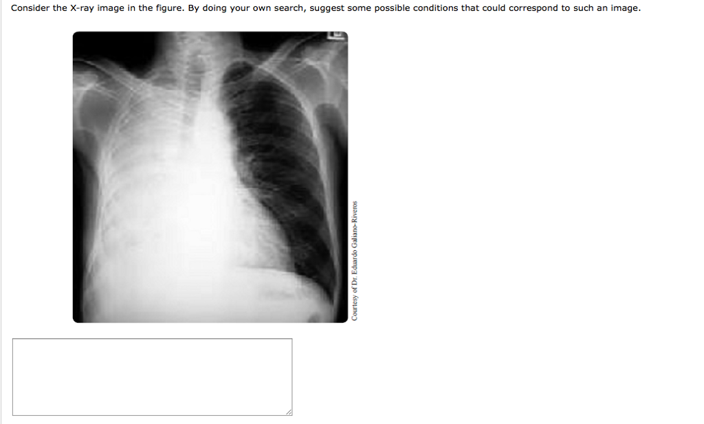Solved Consider the X-ray image in the figure. By doing your | Chegg.com