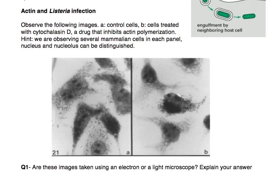 Solved Actin and Listeria infection Observe the following | Chegg.com