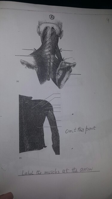 Solved Label the muscles at arrow | Chegg.com