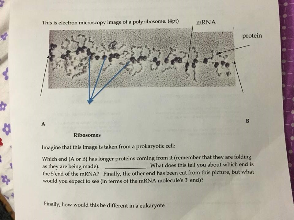 Solved This is electron microscopy image of a polyribosome. | Chegg.com