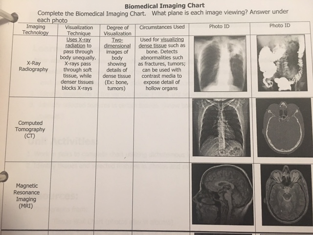 Solved Biomedical Imaging Chart the Biomedical Imaging | Chegg.com