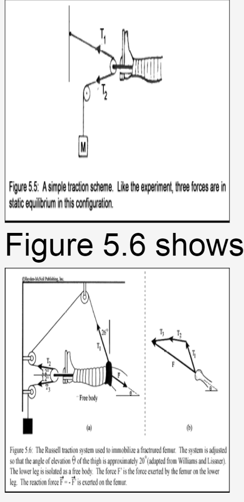 Solved Figure 55: A simple traction scheme. Like the | Chegg.com