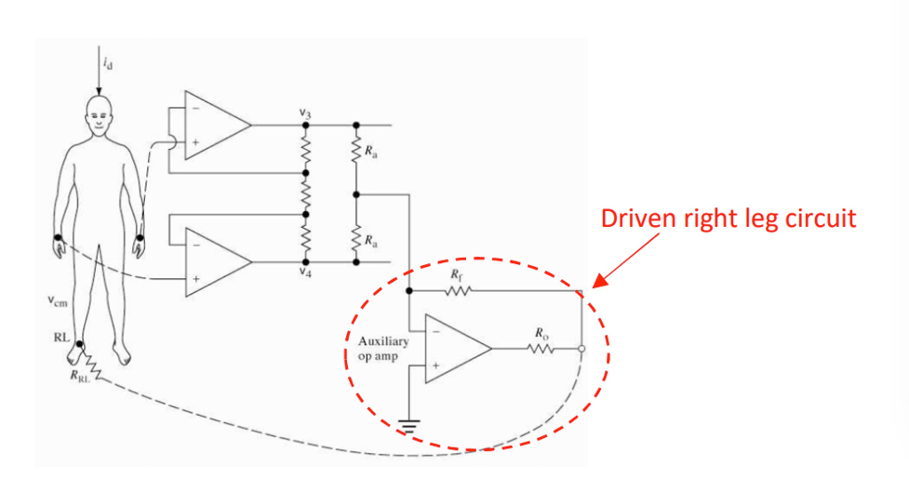 Giving an ECG circuit High-pass Filter 00 nF (G) 100 | Chegg.com