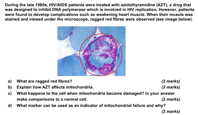 Solved During the late 1980s, HIVIAIDS patients were treated | Chegg.com
