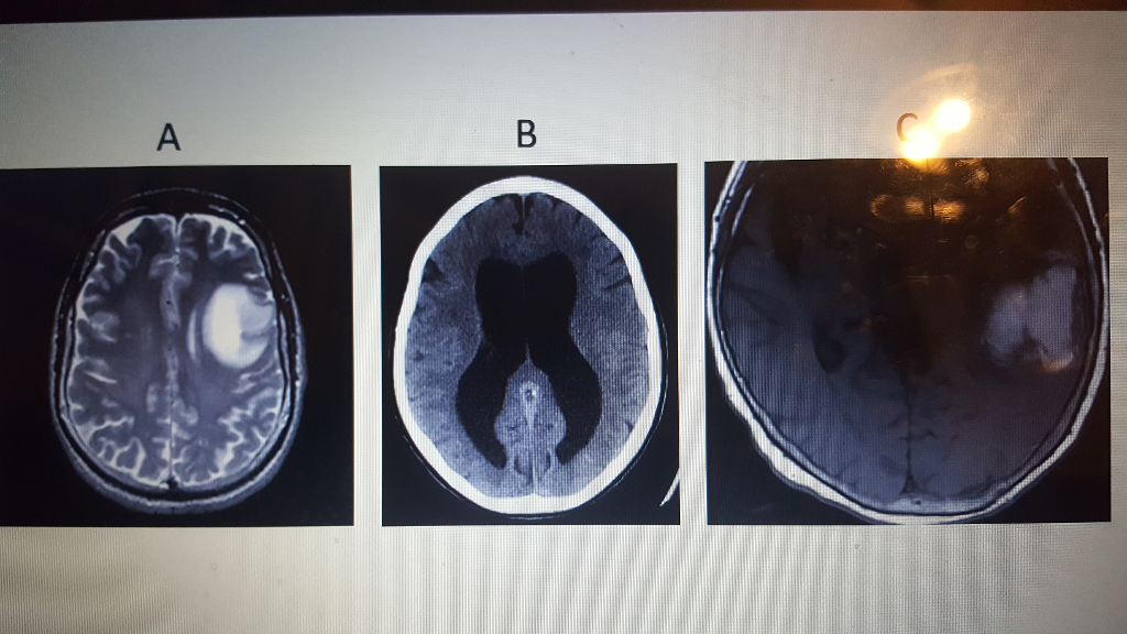 Solved mri or ct ? | Chegg.com