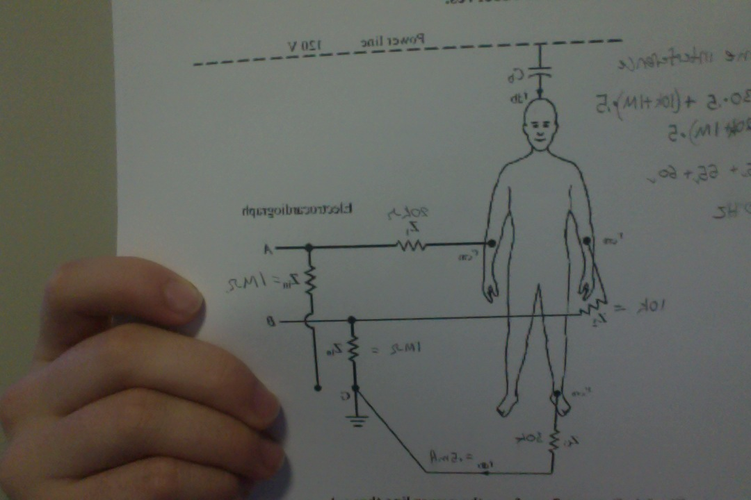 A student attempts to measure his own ECG on an | Chegg.com