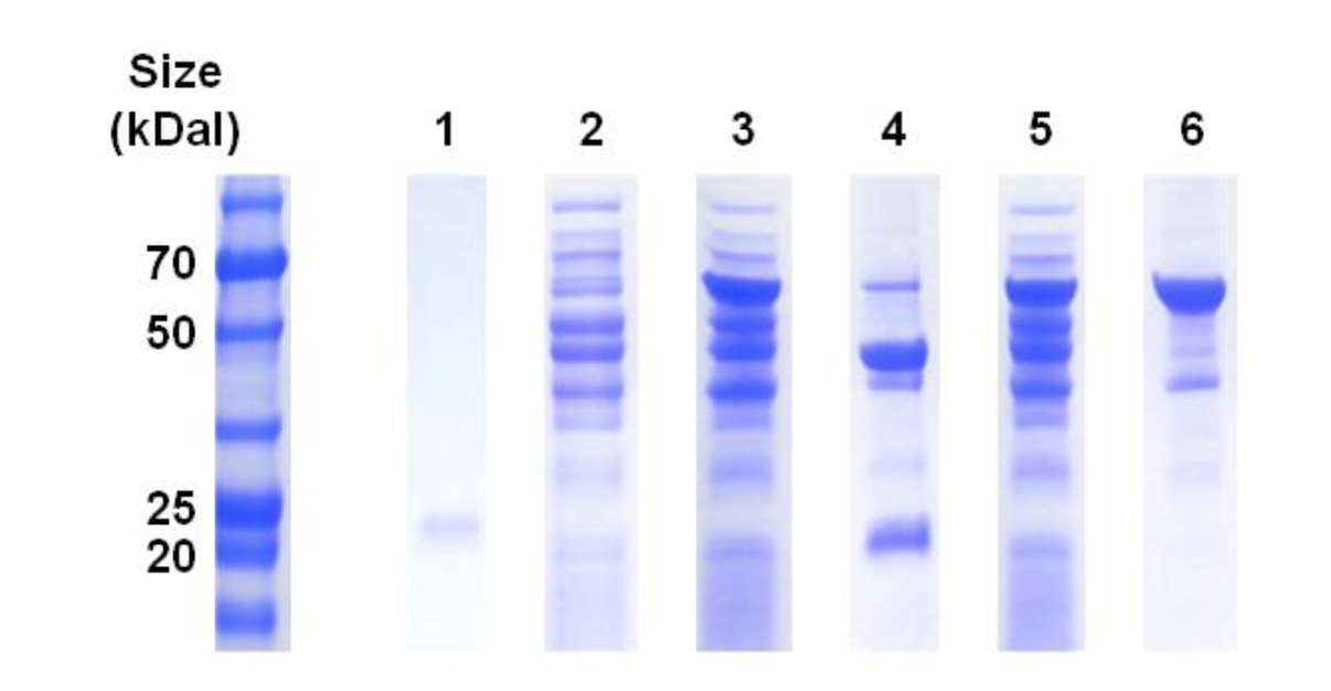 Solved The MBP fusion protein from Question 2 was purified | Chegg.com