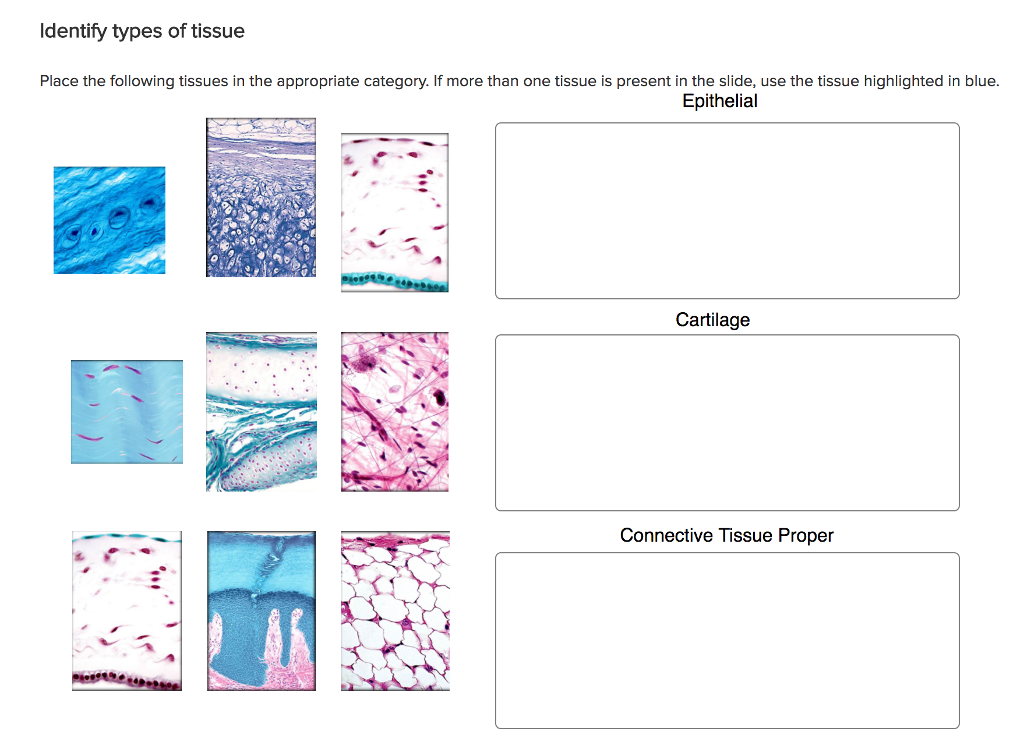 Solved Identify types of tissue Place the following tissues | Chegg.com
