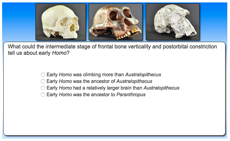 Solved What could the intermediate stage of frontal bone | Chegg.com