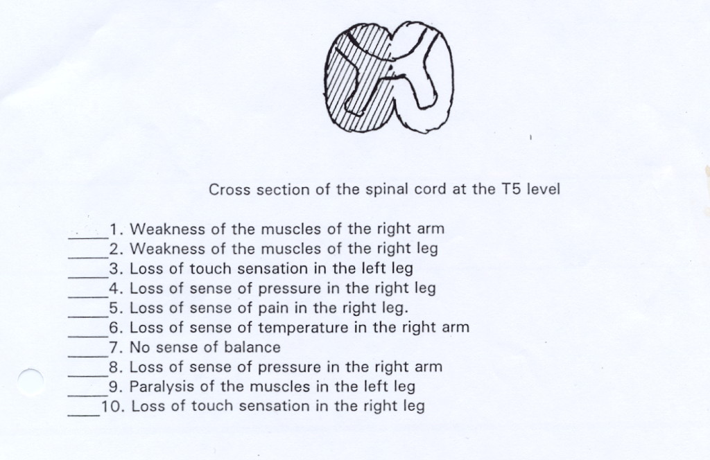 Cross section of the spinal cord at the T5 level 1. | Chegg.com